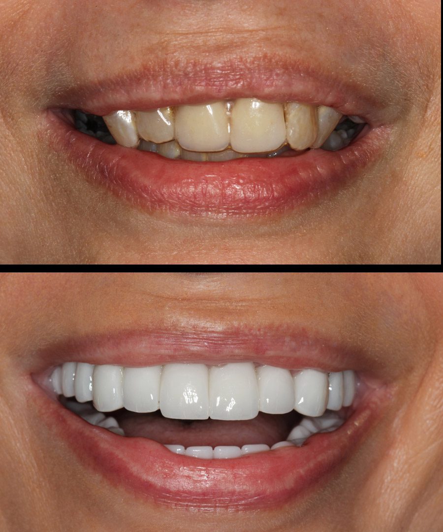 What IS a Prosthodontist? - Dental Implant Center