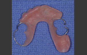 Dentures and Partial Dentures - Dental Implant Center