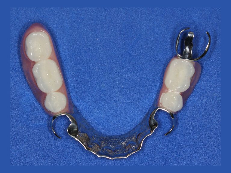 Dentures and Partial Dentures - Dental Implant Center