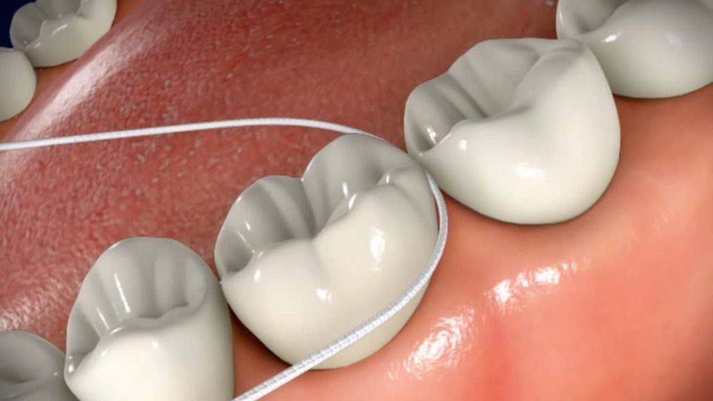 Flossing: A to Z! - Dental Implant Center