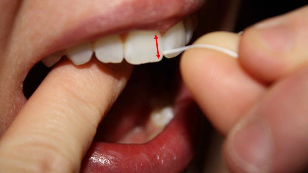 Flossing: A to Z! - Dental Implant Center