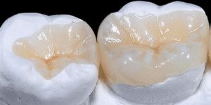 Aesthetic Dentistry - Dental Implant Center